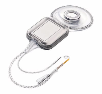 Implantable Hearing Devices | Rocky Mountain Ear Center